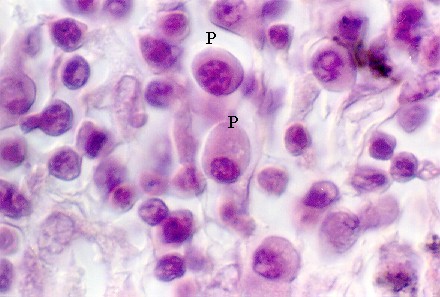 Plasma cell